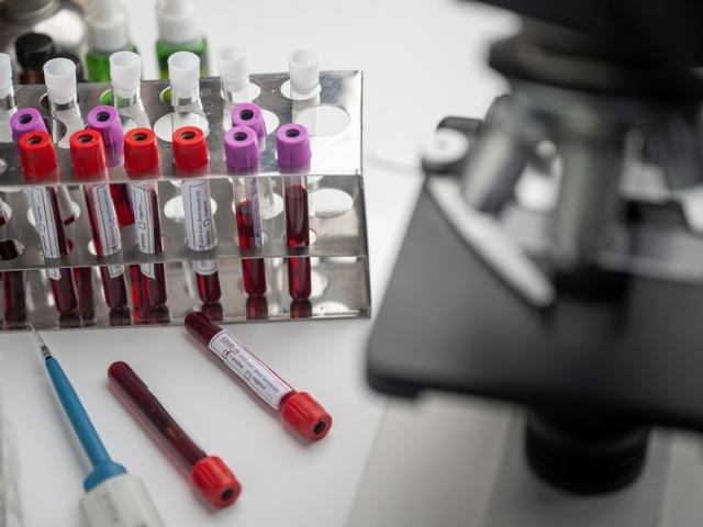 Seven UCT Researchers Awarded ‘Career Starting’ SAMRC Grants ...